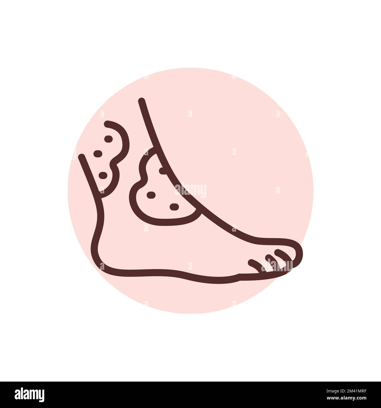 Atopic Dermatitis Black Line Icon Dermatology Disease Skin Problem