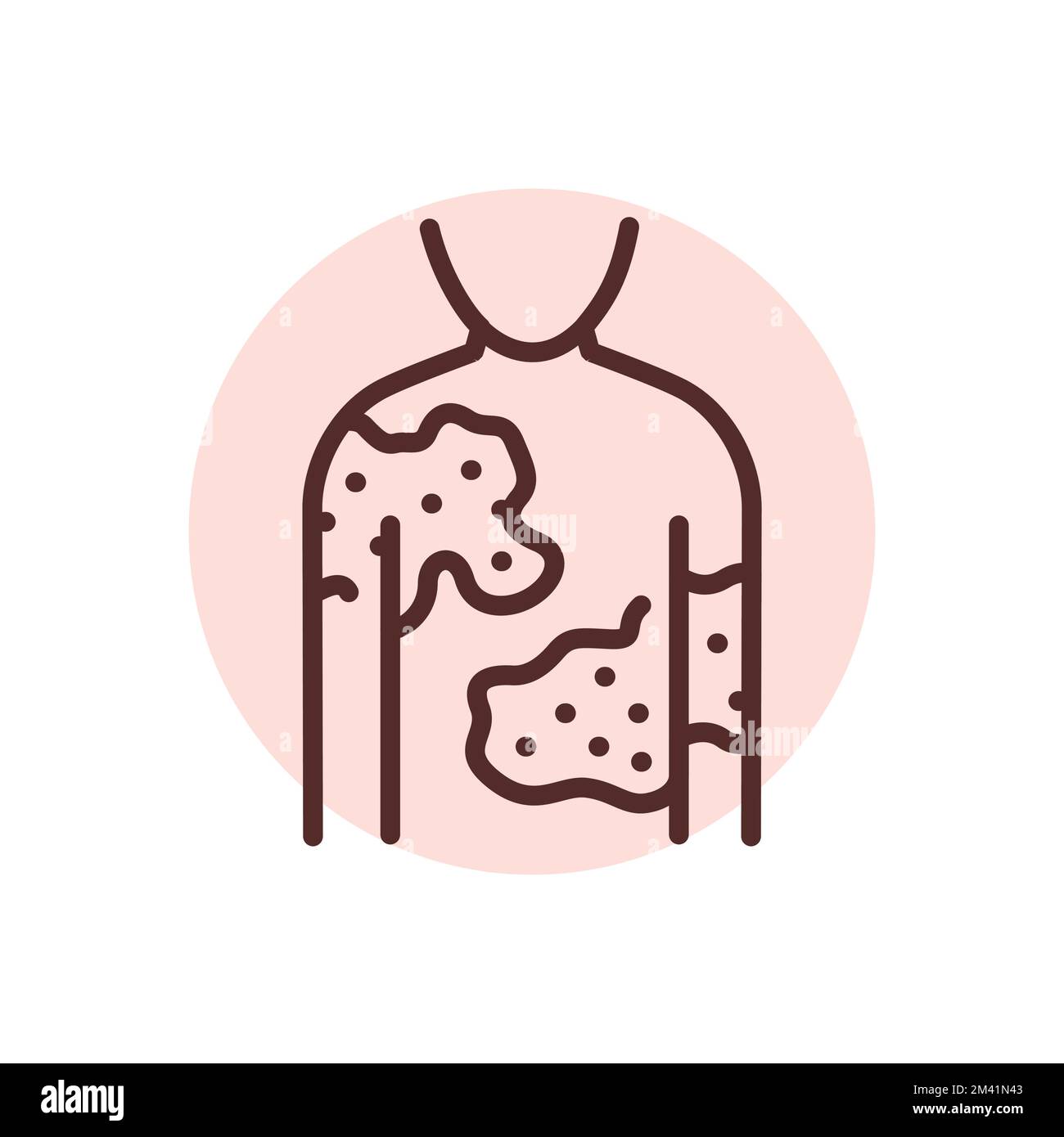 Urticaria vector vectors hi-res stock photography and images - Alamy