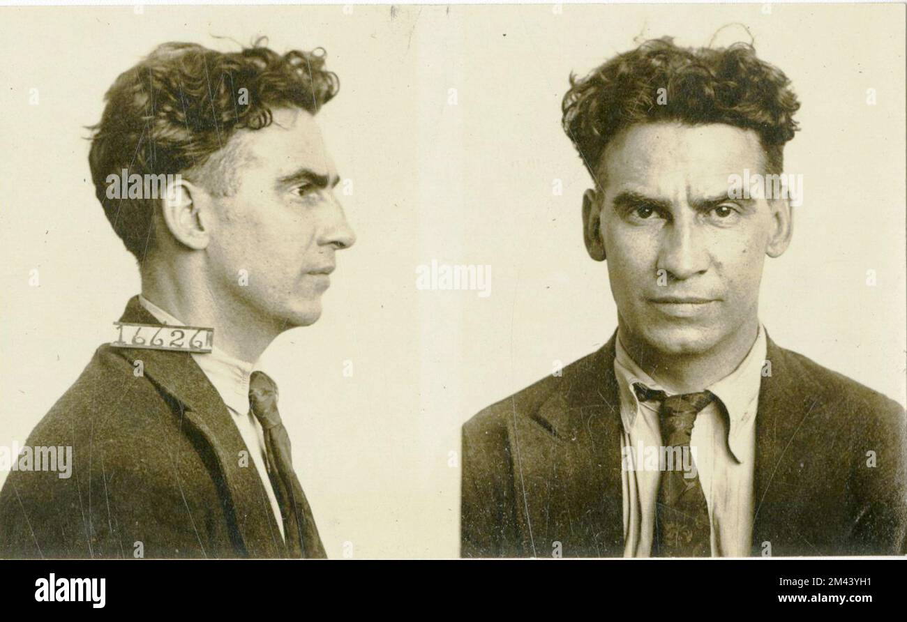 James Chadwick Saw What In The Microscope