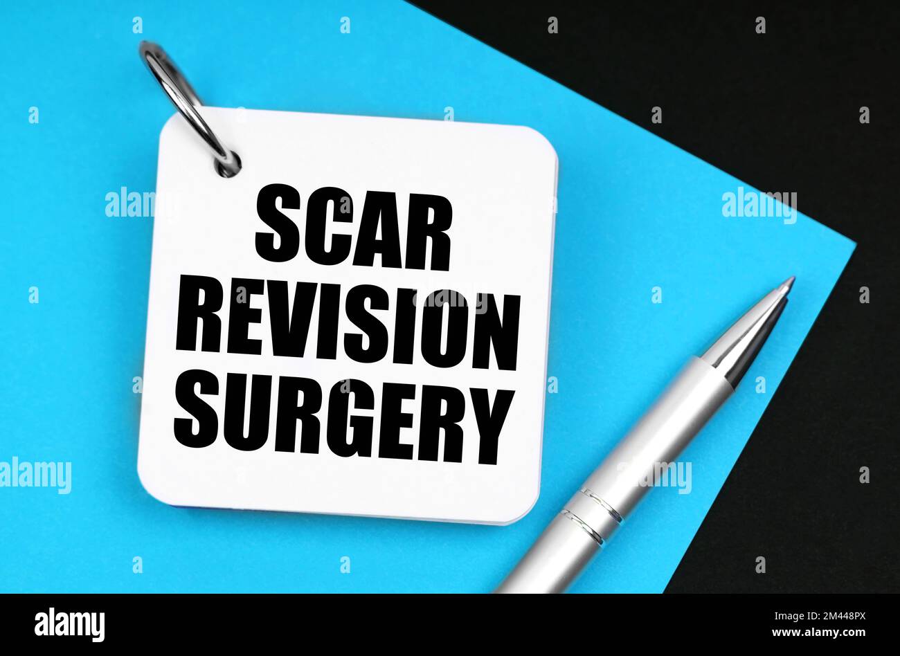 Scar revision surgery hi-res stock photography and images - Alamy