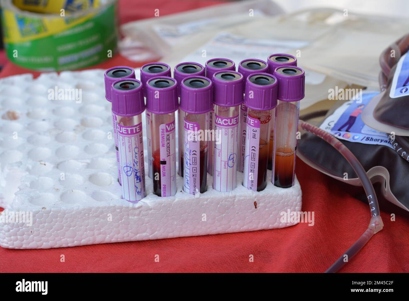 Cairo, Egypt, December 15 2022: blood samples in tubes collected from ...