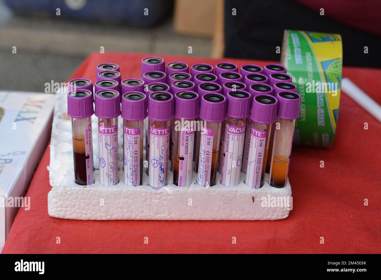 Cairo, Egypt, December 15 2022: blood samples in tubes collected from ...