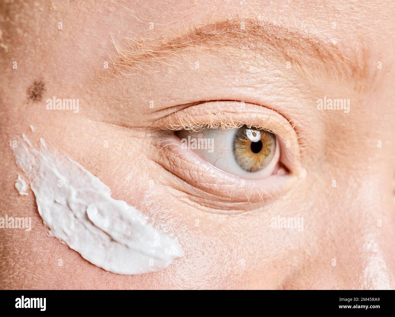 Beauty, albino and woman closeup with sunscreen, product and spf ...