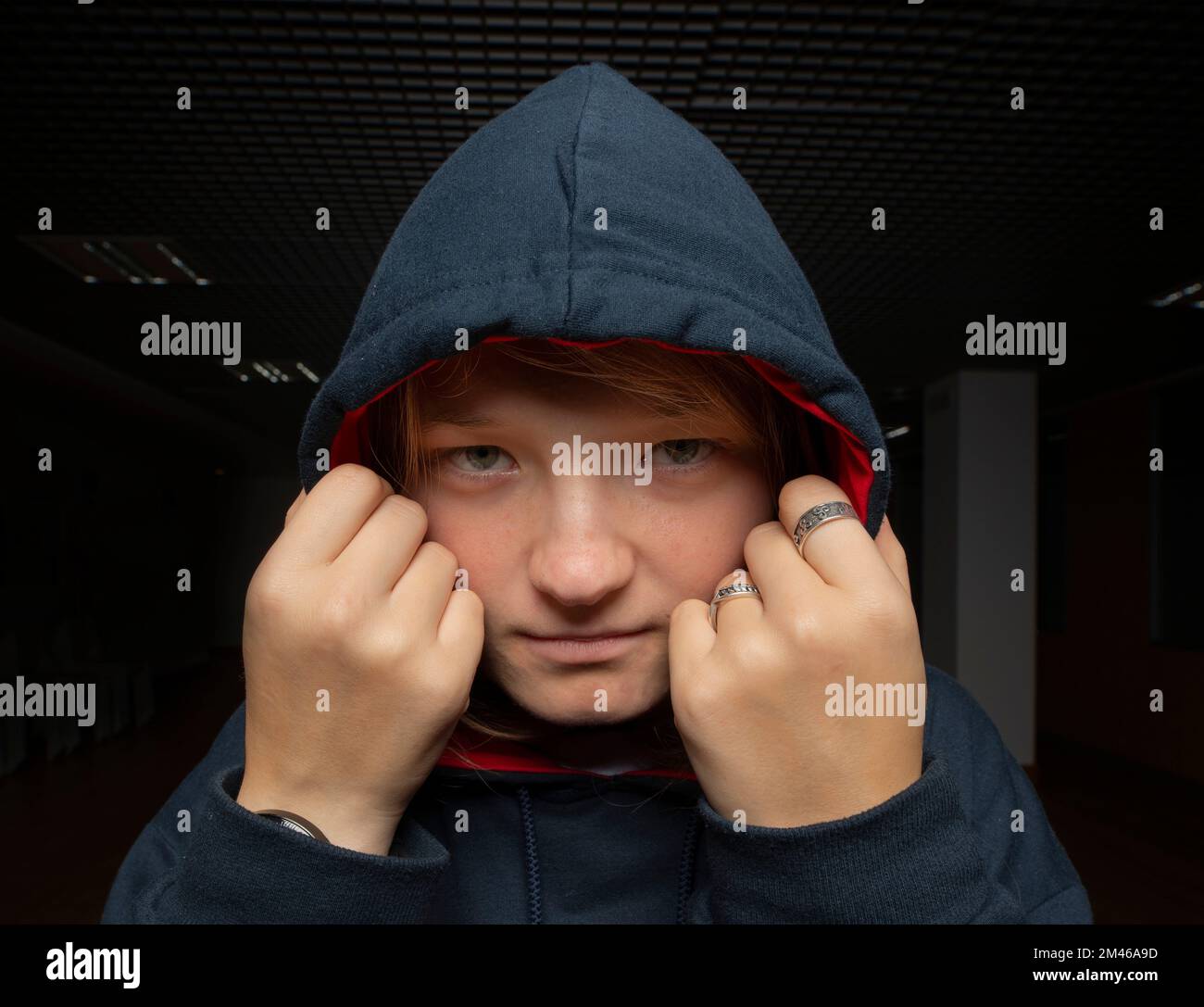 Fetal Alcohol Syndrome Teenager