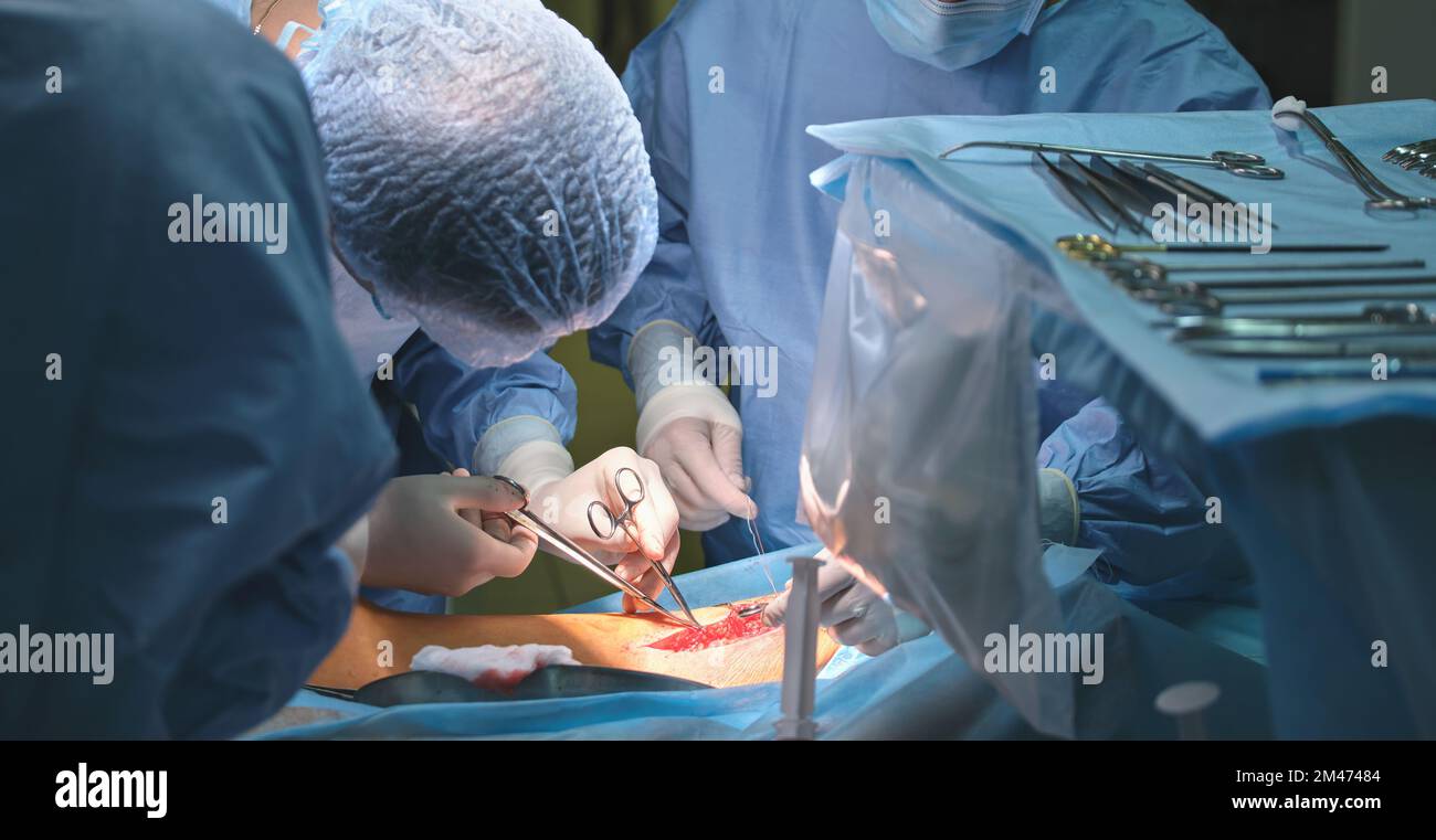 Team of surgery doctors operating a patient in surgical room ...