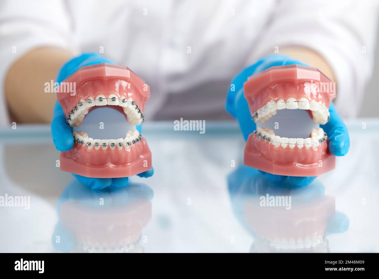 Orthodontist showing model of human jaw with wire braces and aligners ...