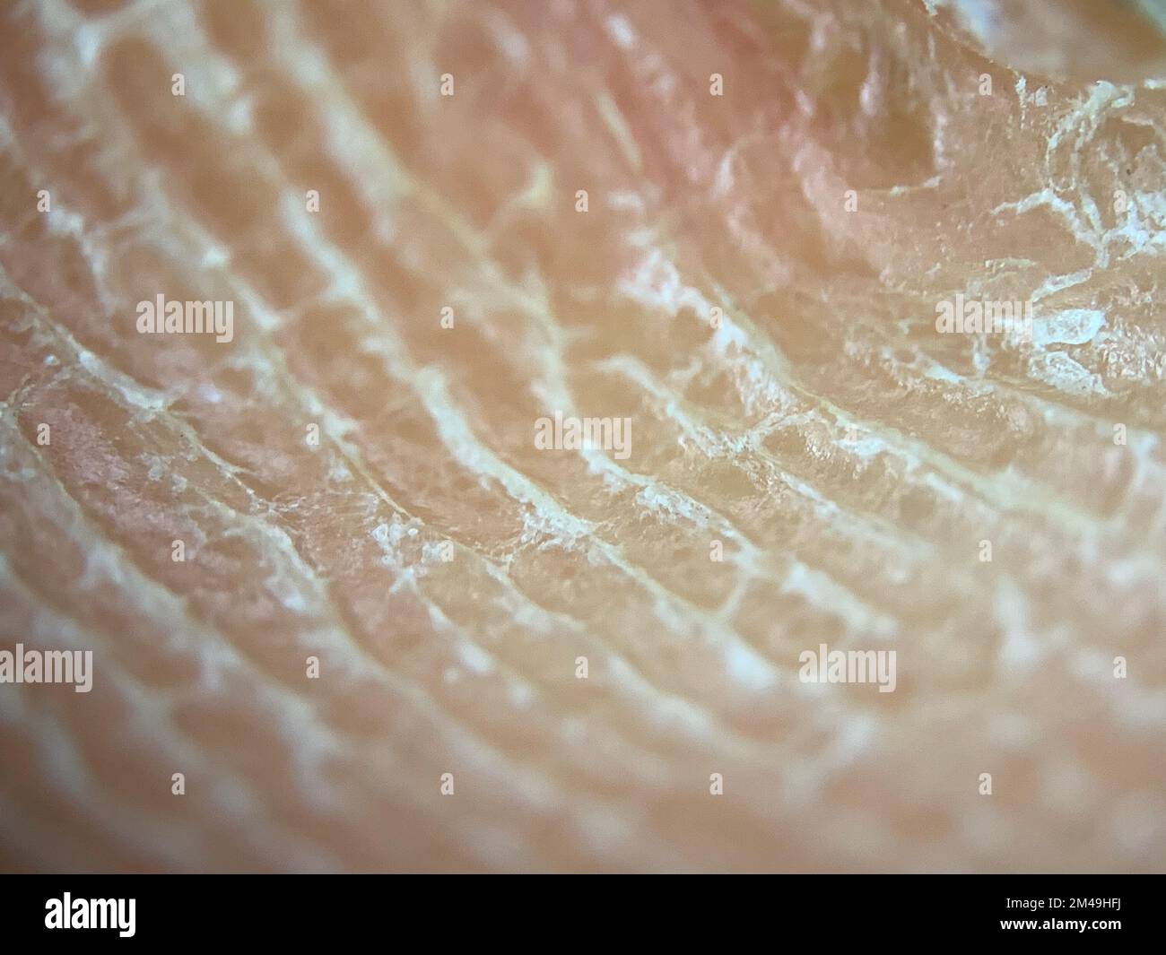 Human skin microscope hi-res stock photography and images - Alamy