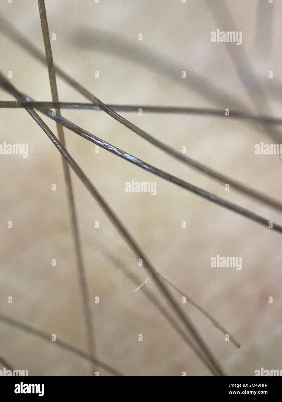 Hair Shedding With White Bulb