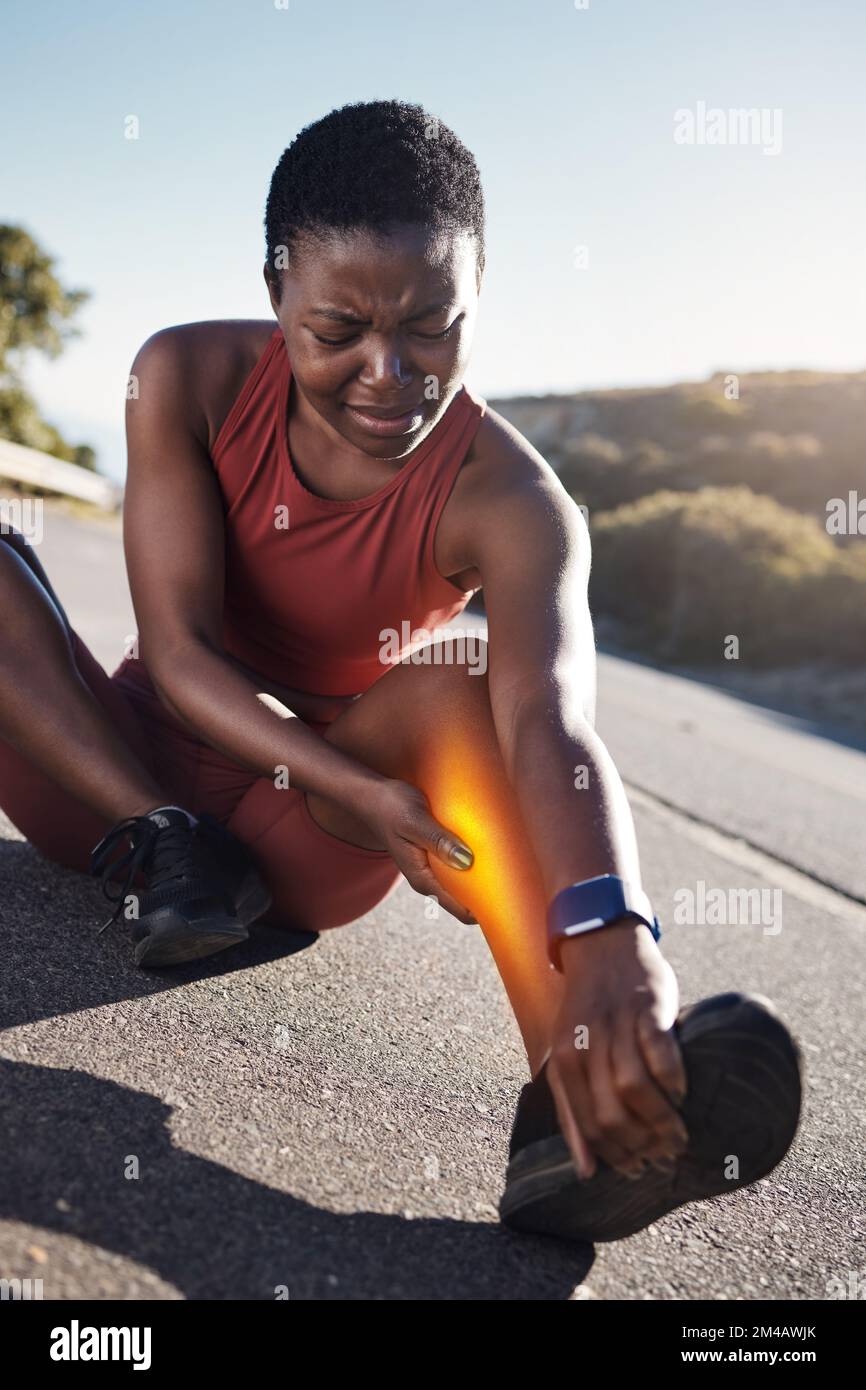 Fitness, black woman and leg injury from sports, accident or running ...