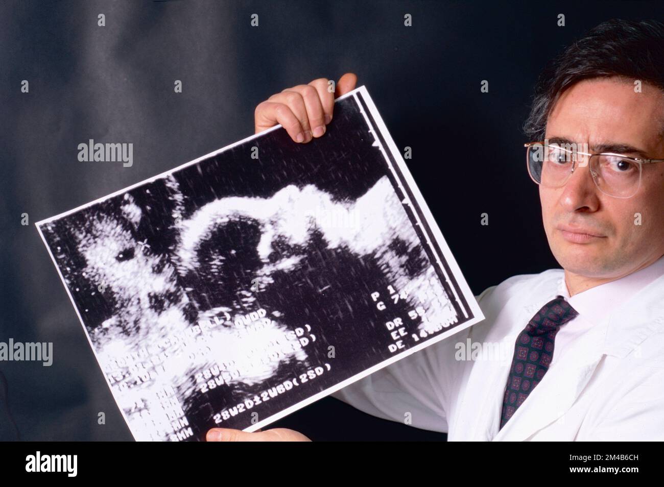 Italian gynecologist Professor Pasquale Bilotta showing ultrasound ...