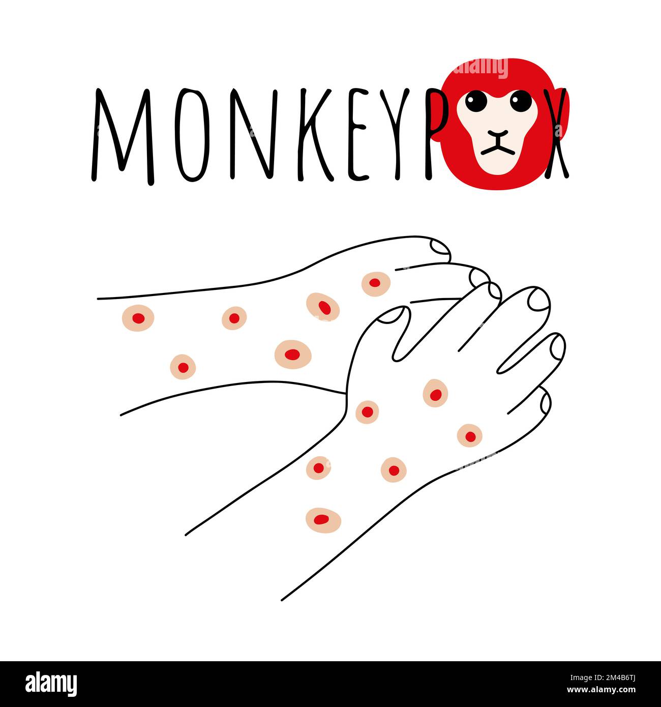 Monkeypox virus symptom doodle concept. Monkey face and hands with rash ...