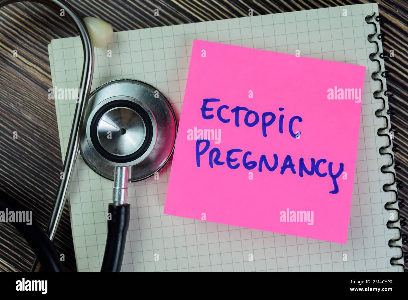 Concept of Ectopic Pregnancy write on sticky notes with stethoscope ...