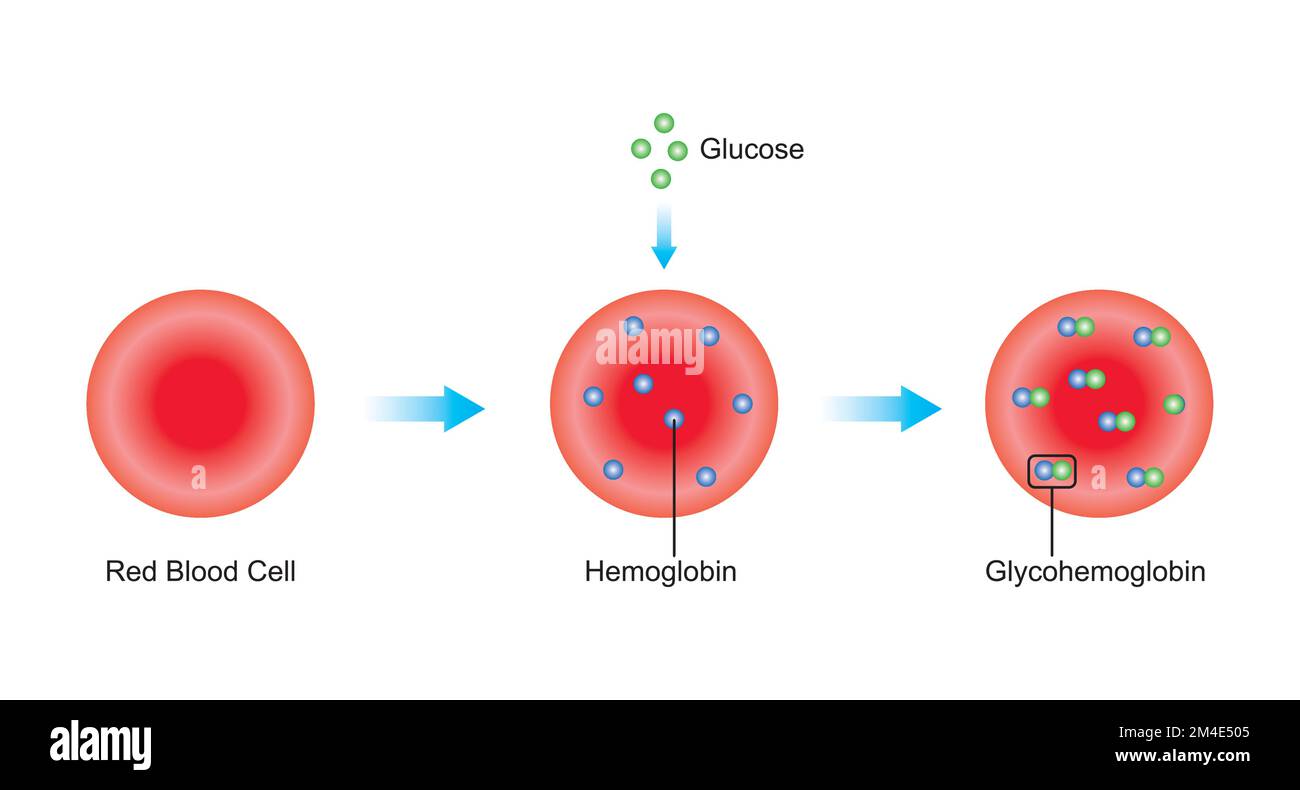 Scientific Designing of Glycosylated Hemoglobin Formation. Colorful ...