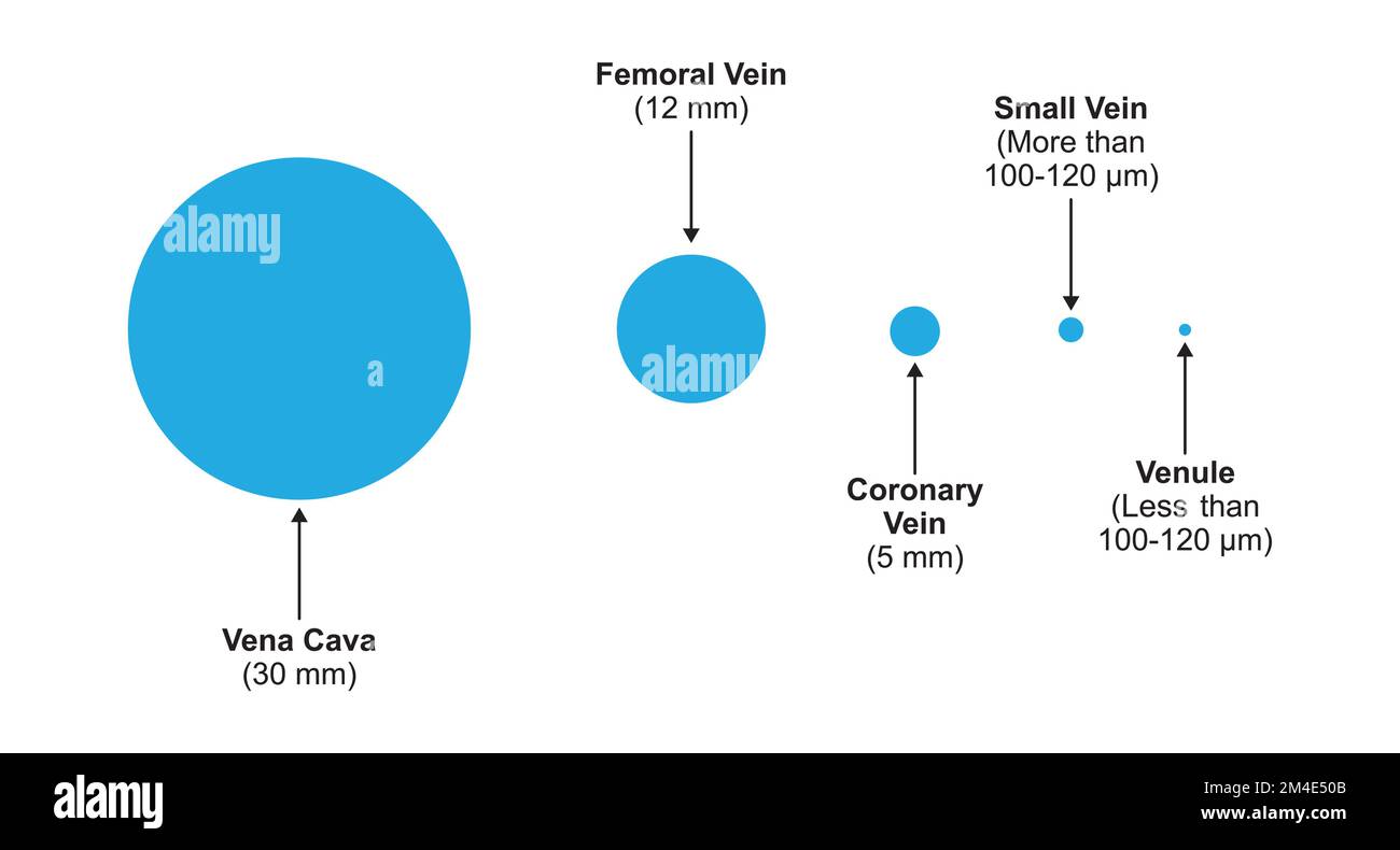 Scientific Designing of Blood Vessels Diameter Comparison. Colorful ...