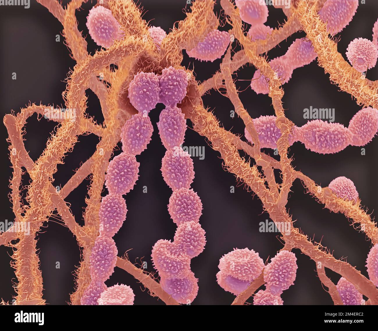 Aspergillus fungus, SEM Stock Photo - Alamy