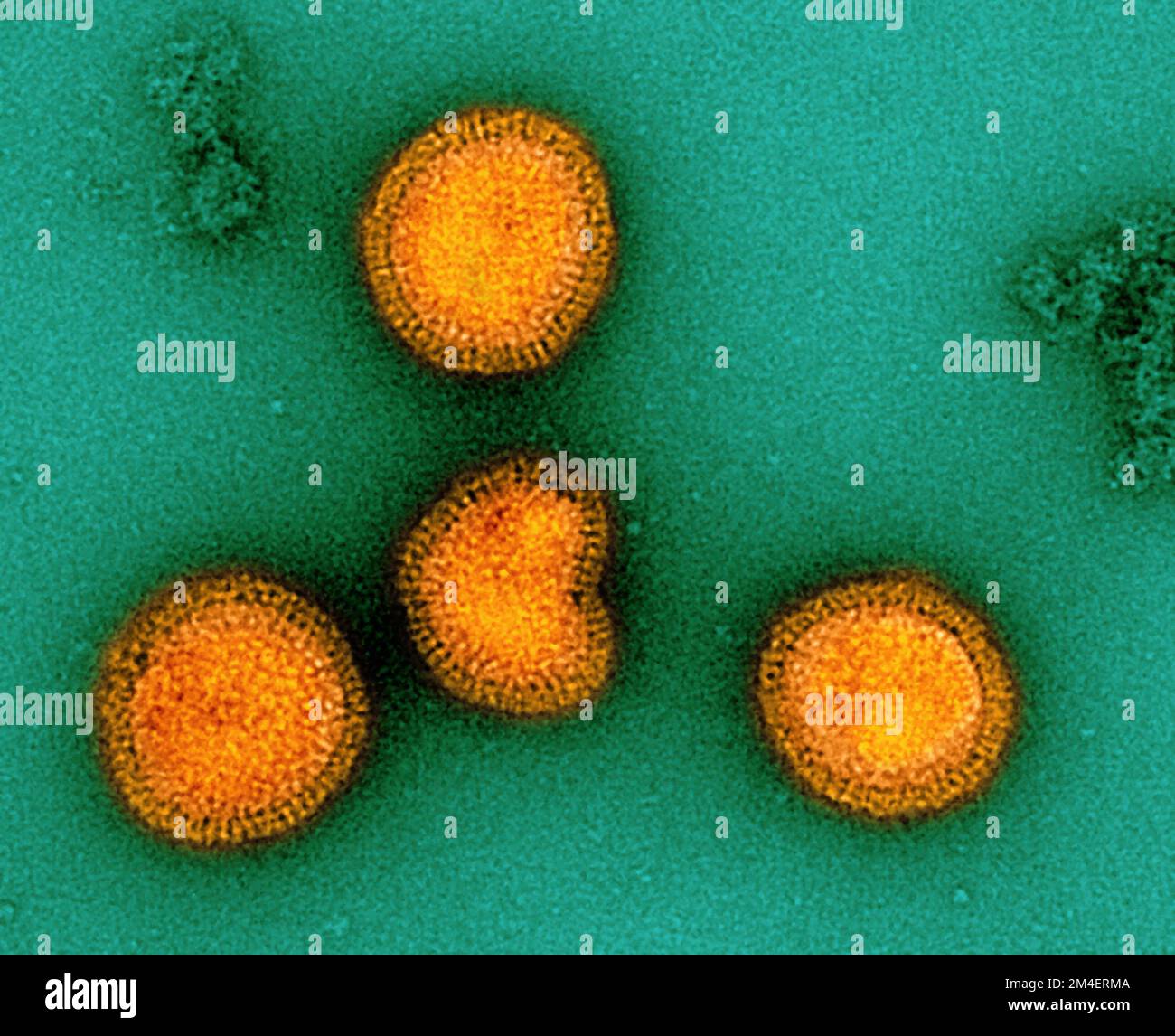 Influenza B virus particles, TEM Stock Photo - Alamy