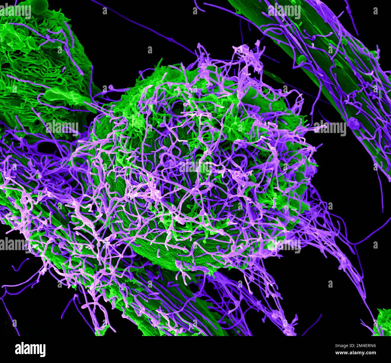 Ebola virus budding from cell, SEM Stock Photo - Alamy