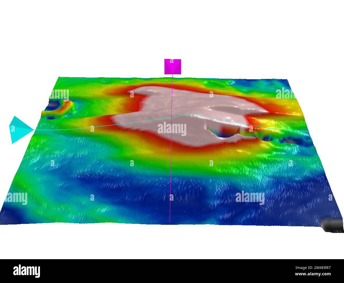 Diabetic macular oedema, OCT macular cube scan Stock Photo - Alamy Diabetic macular oedema, OCT macular cube scan Stock Photo - Alamy