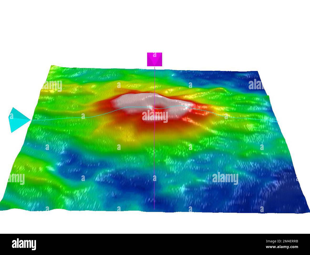 Diabetic macular oedema, OCT macular cube scan Stock Photo - Alamy