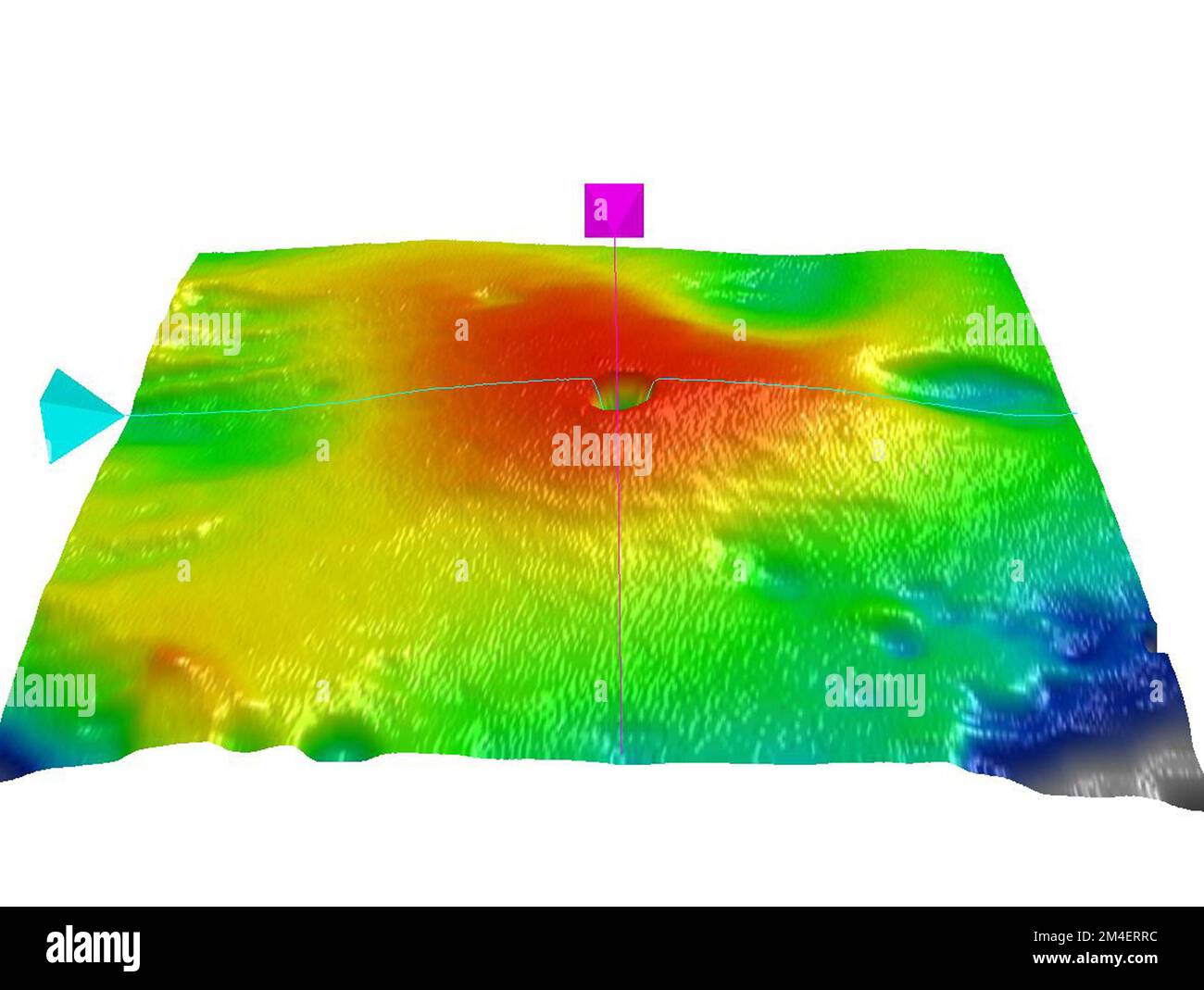 Macular pucker with lamellar hole, OCT macular cube scan Stock Photo ...