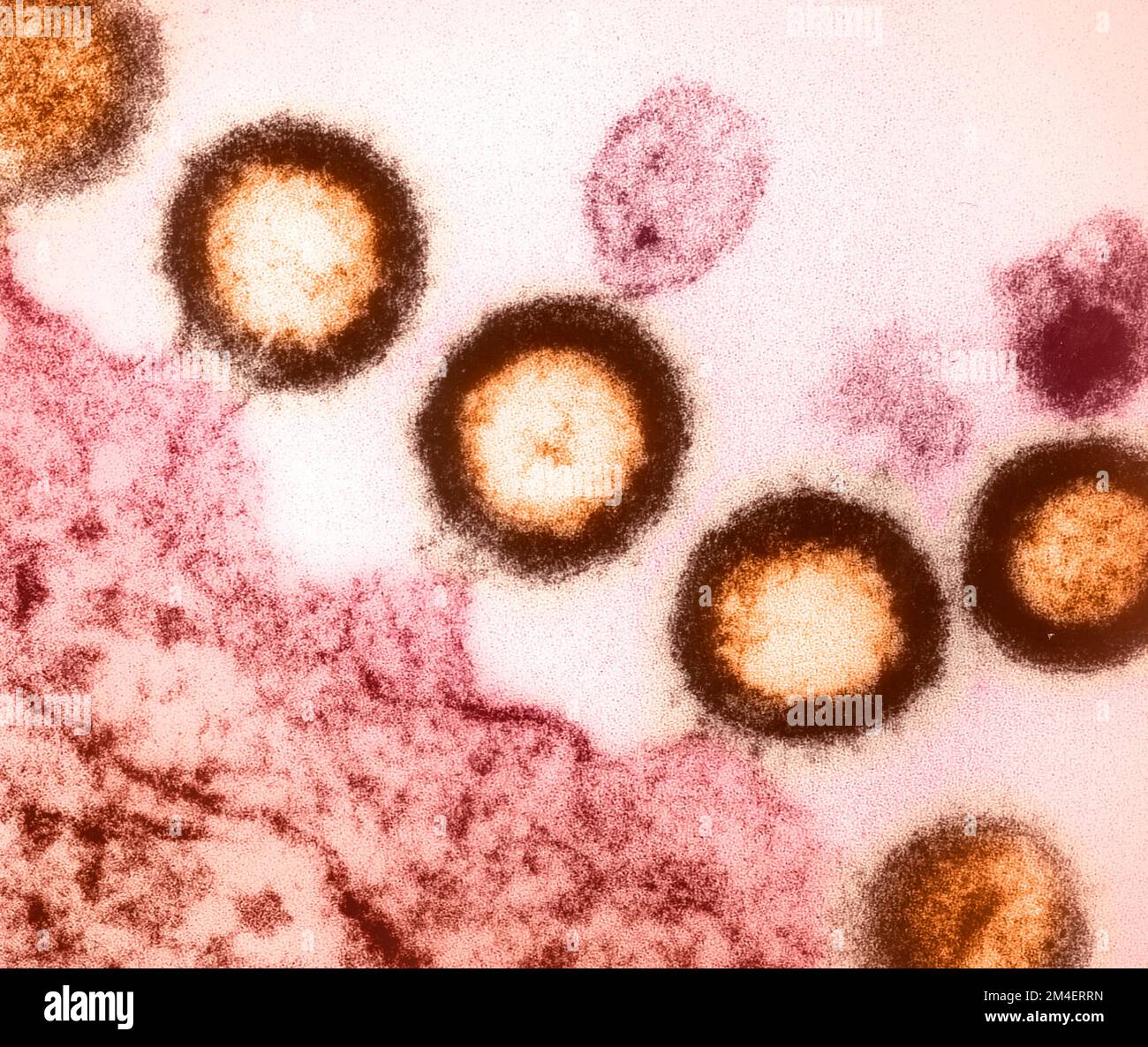 HIV particles budding from cell, TEM Stock Photo - Alamy