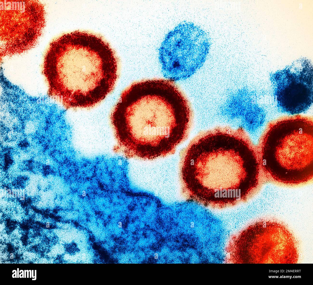 HIV particles budding from cell, TEM Stock Photo - Alamy