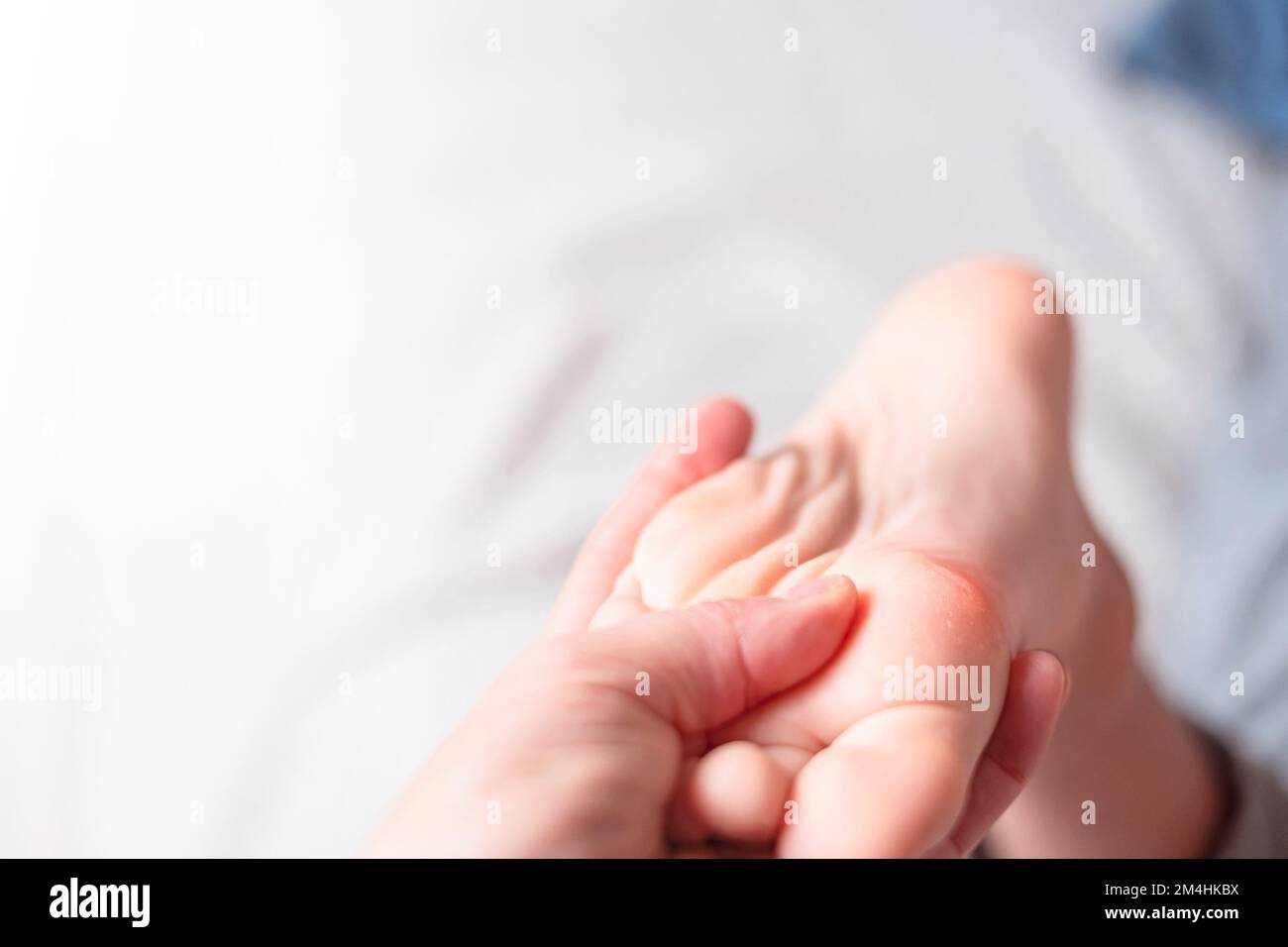 Close up of calluses. Problem skin on the steps of a teenager Stock ...