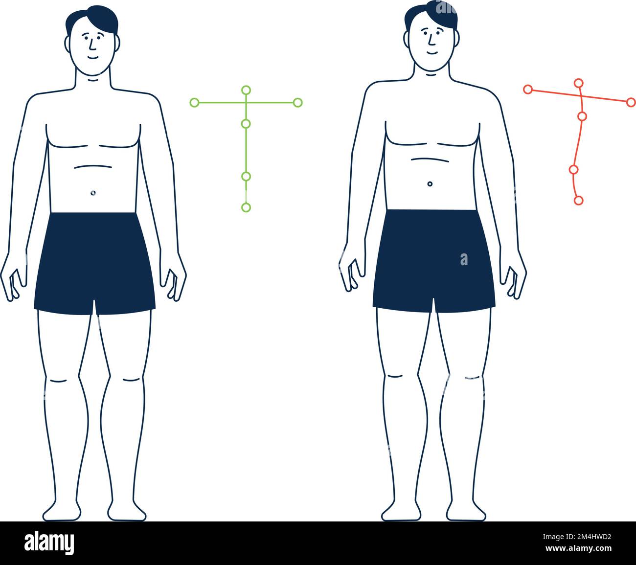 Good posture and bad posture hi-res stock photography and images - Alamy