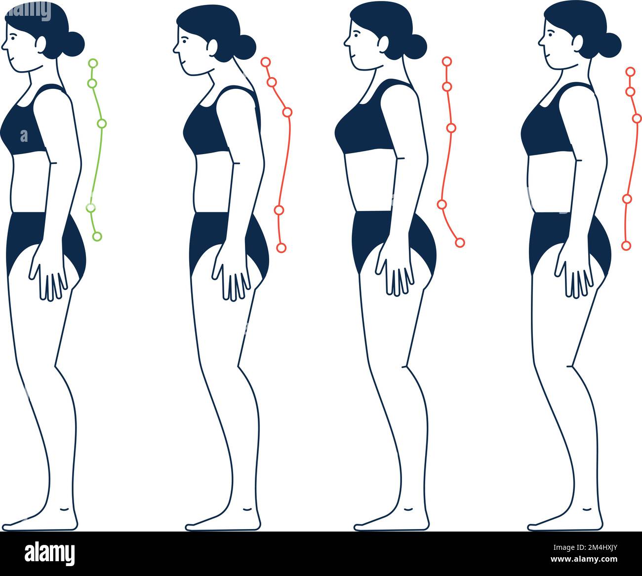 Woman back correction side view. Wrong and right postures Stock Vector ...