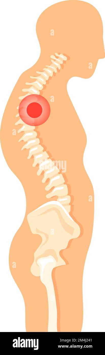 Human figure with spine pain side view. Anatomy illustration isolated ...