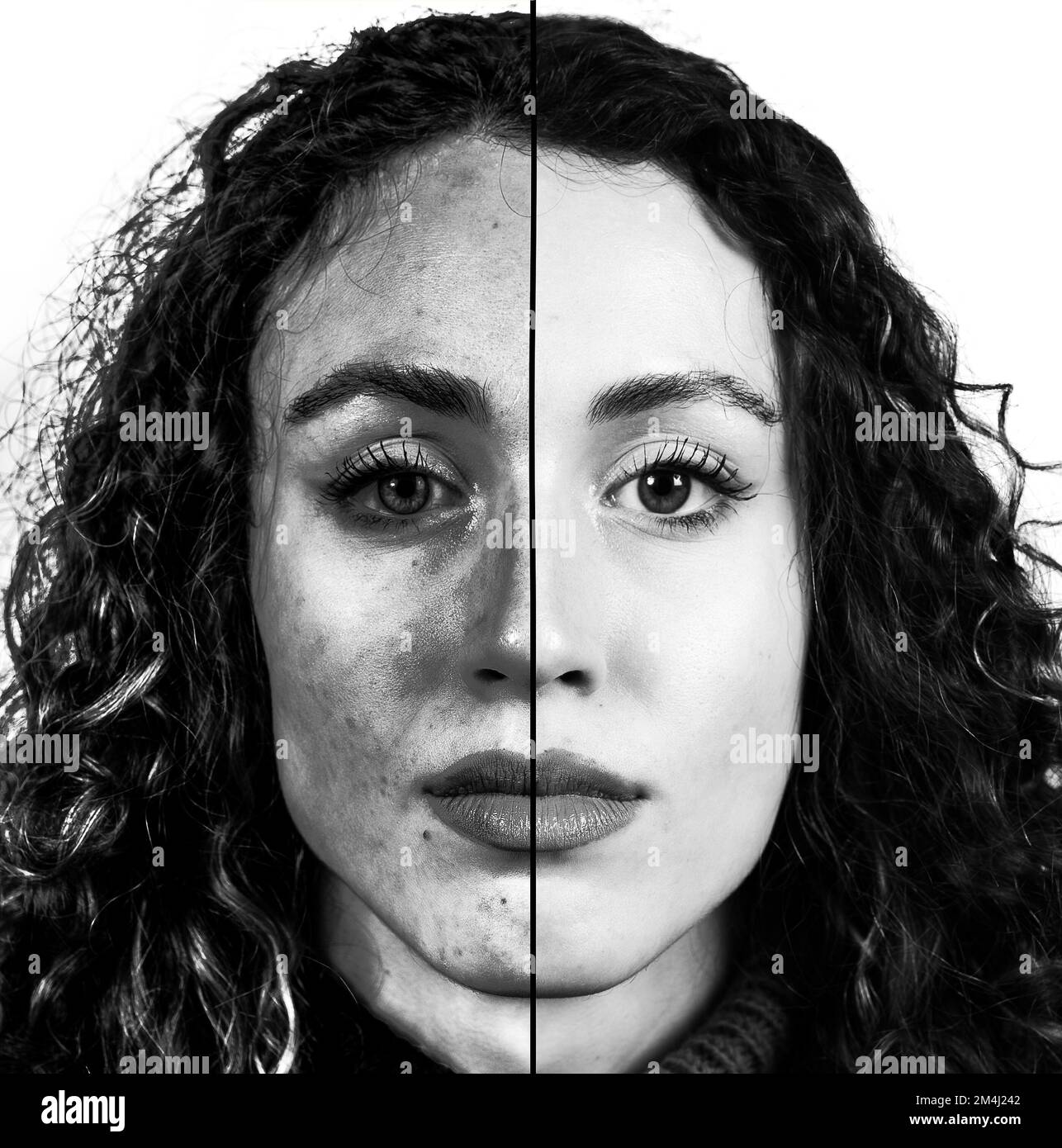 Effects of uv rays hi-res stock photography and images - Alamy