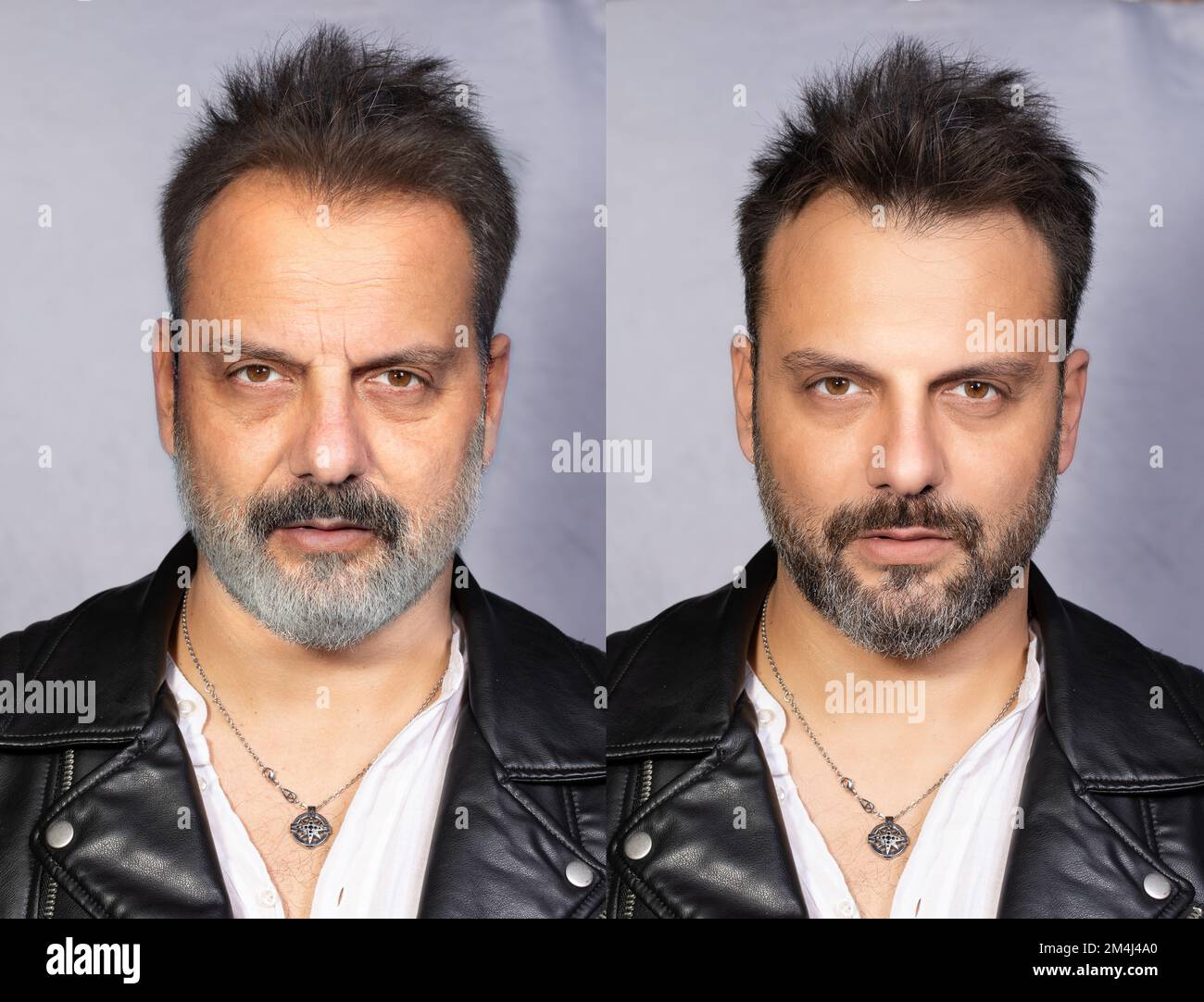 Simulation of before and after a rejuvenating treatment, removal of the ...