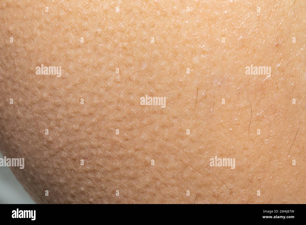 Goosebumps hi-res stock photography and images - Alamy