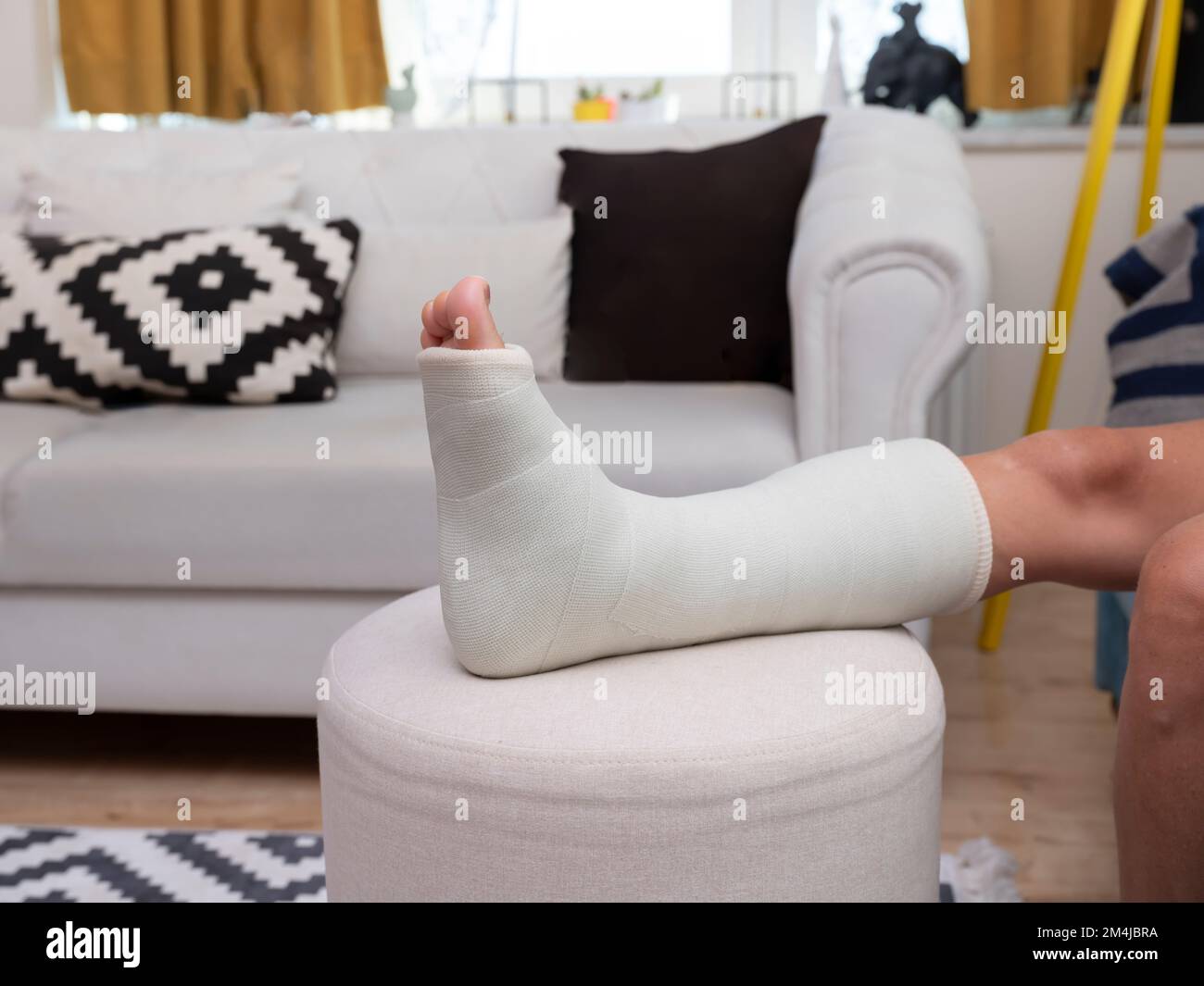 A woman with a broken leg Stock Photo - Alamy