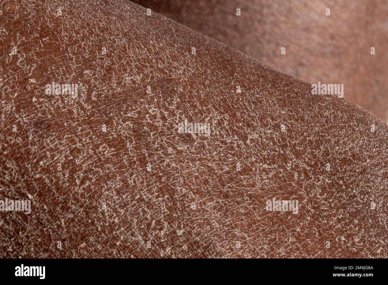 Macro detail of the dry skin of the legs of an African woman. Selective ...