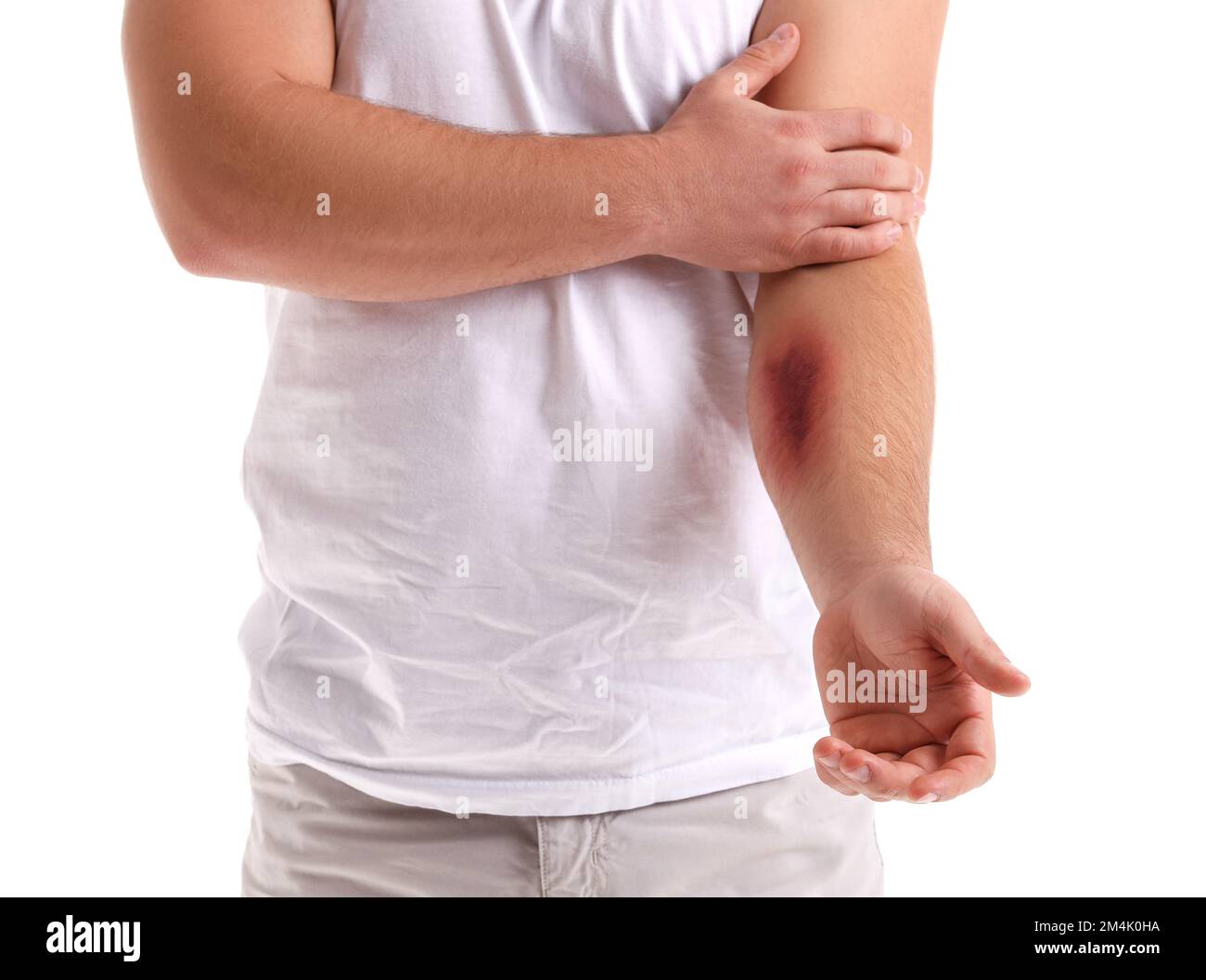 Man with bruise on arm against white background Stock Photo - Alamy