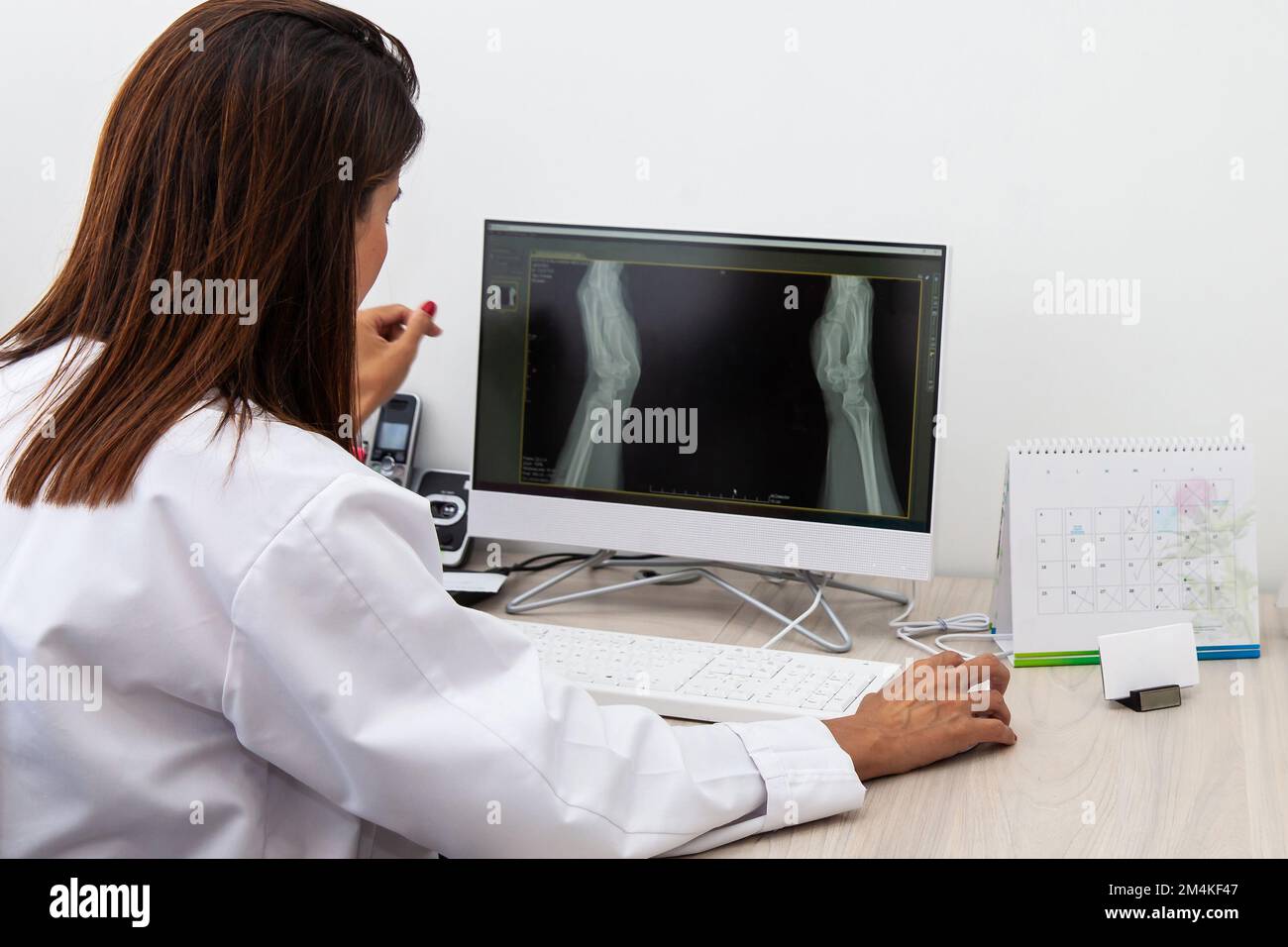 Traumatologist female doctor reviewing an x-ray of a patient's hands ...