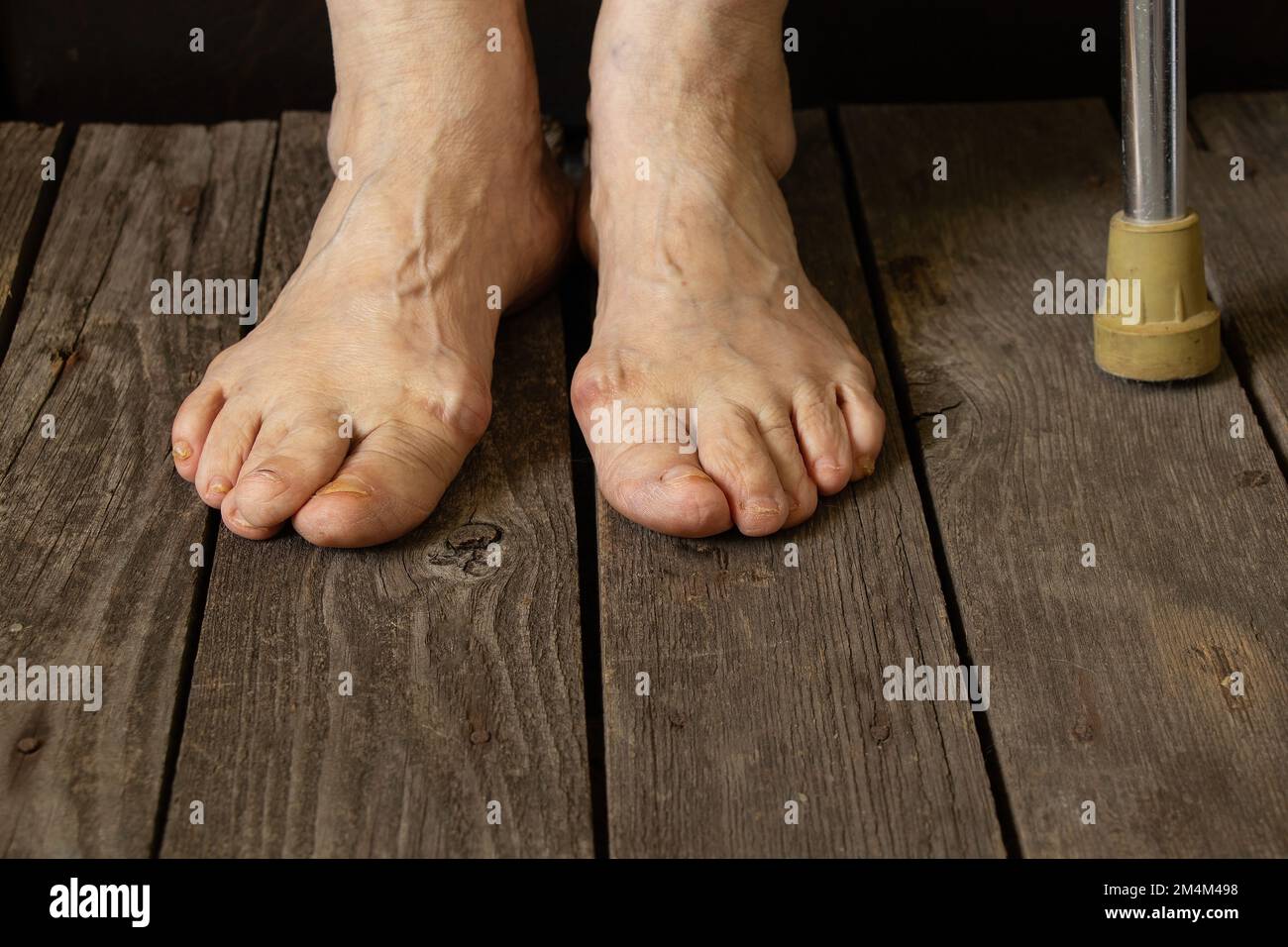 old grandmother's feet on the floor in her room close-up Stock Photo ...