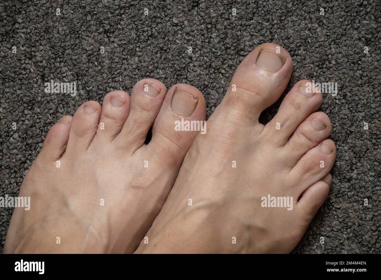 female feet on gray carpet barefoot at home close up Stock Photo - Alamy