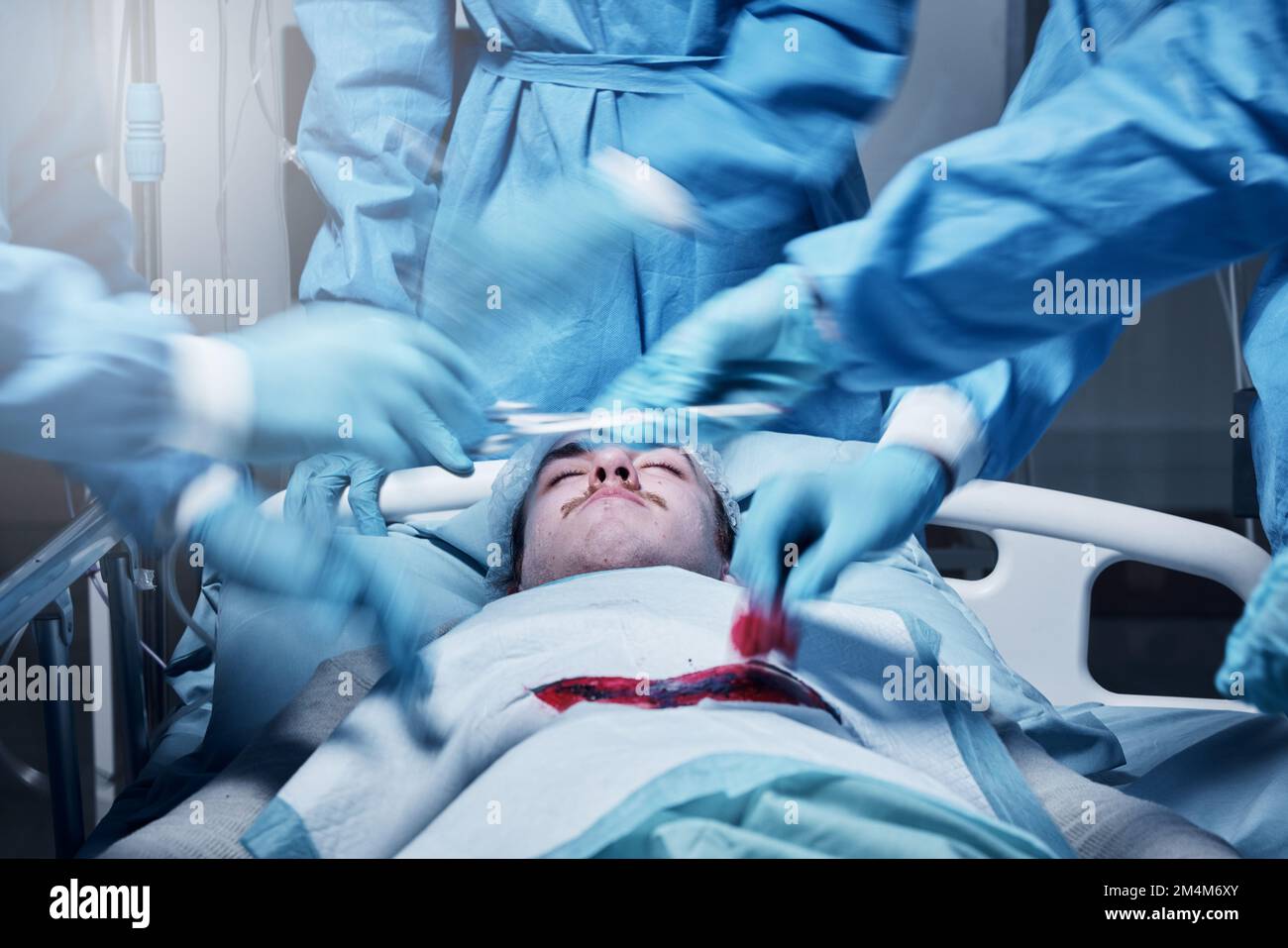 Surgery team, doctor and blood in medical hospital room for healthcare ...