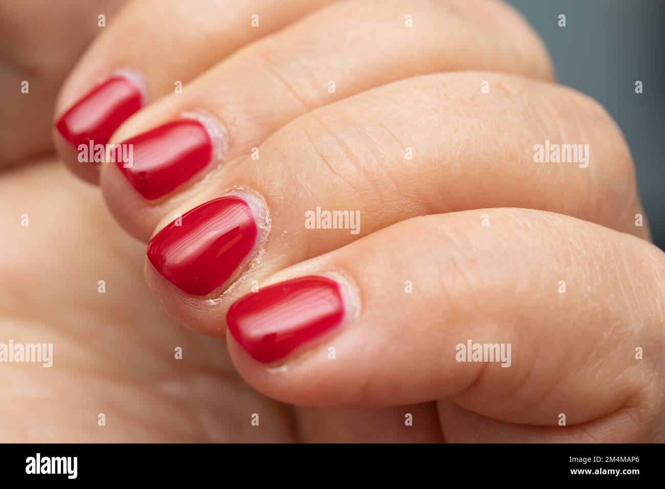 Lady's nails with bright red nail polish in which regrowth can be seen ...