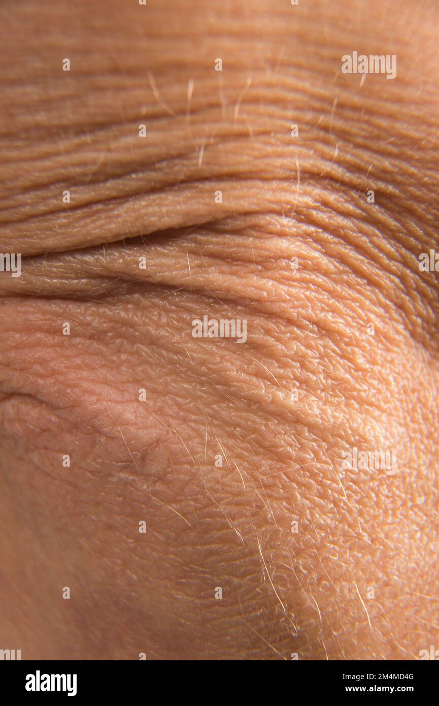 Closeup of wrinkles skin in deep layers. Healthcare, medical and ...