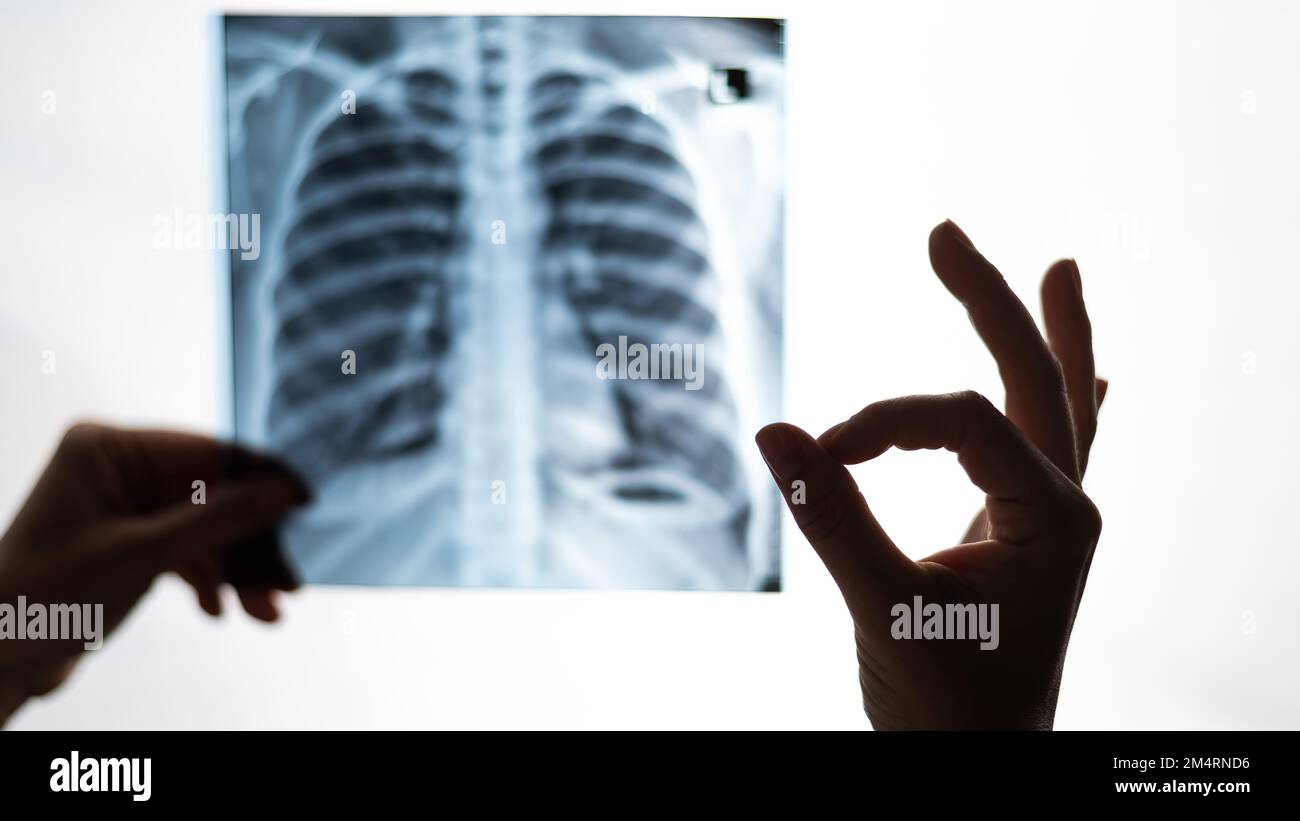 The doctor looks at the x-ray of the patient's lungs and shows the ok ...