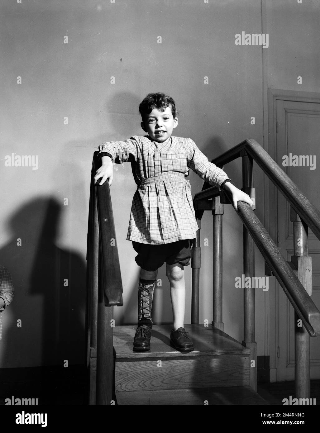 Child cripped by infantile paralysis. Photographs of Marshall Plan ...