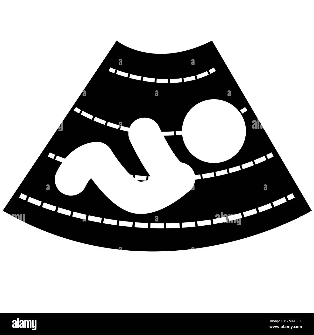 Ultrasonography baby icon on white background. Ultrasonography sign ...