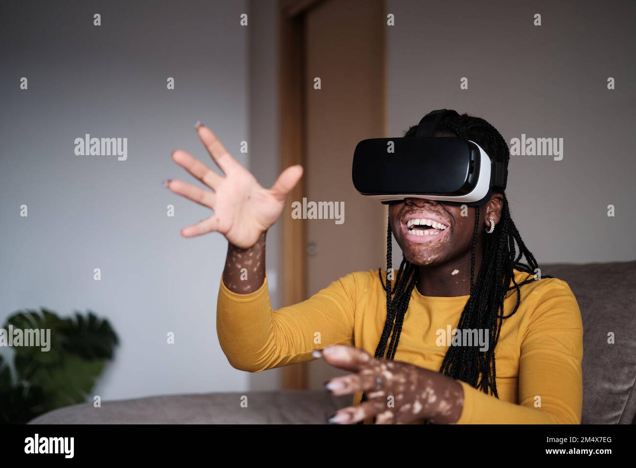 Excited black woman with vitiligo skin playing VR game Stock Photo - Alamy