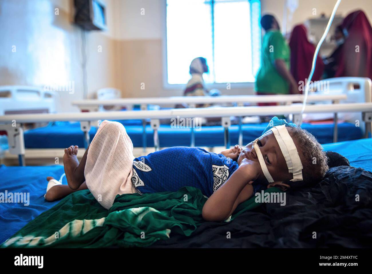 Mogadishu, Somalia. 15th Dec, 2022. Abdirahman, eleven months old, was ...