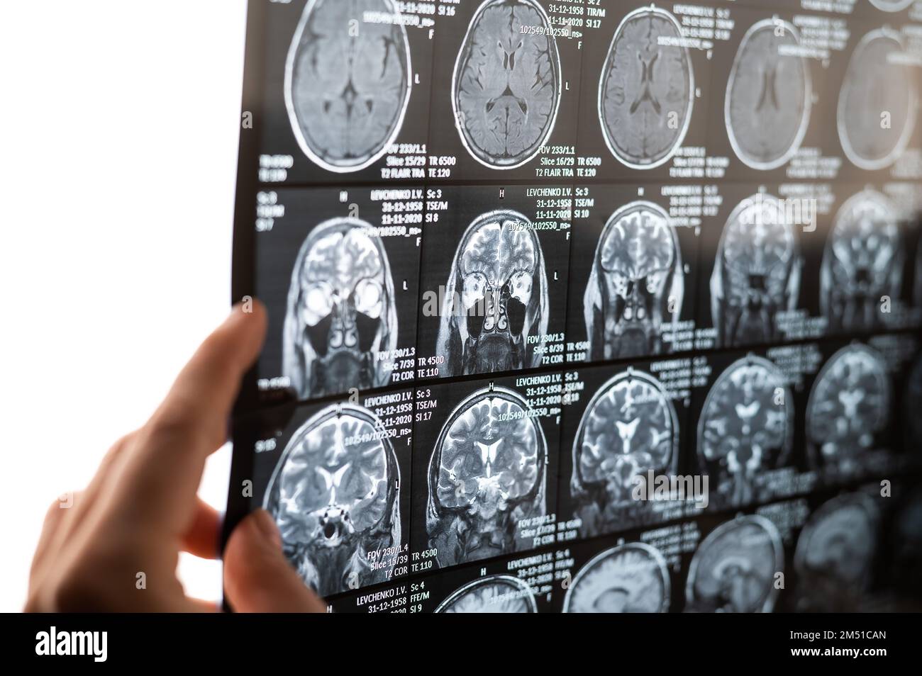A female doctor examines an MRI scan of the brain Stock Photo - Alamy