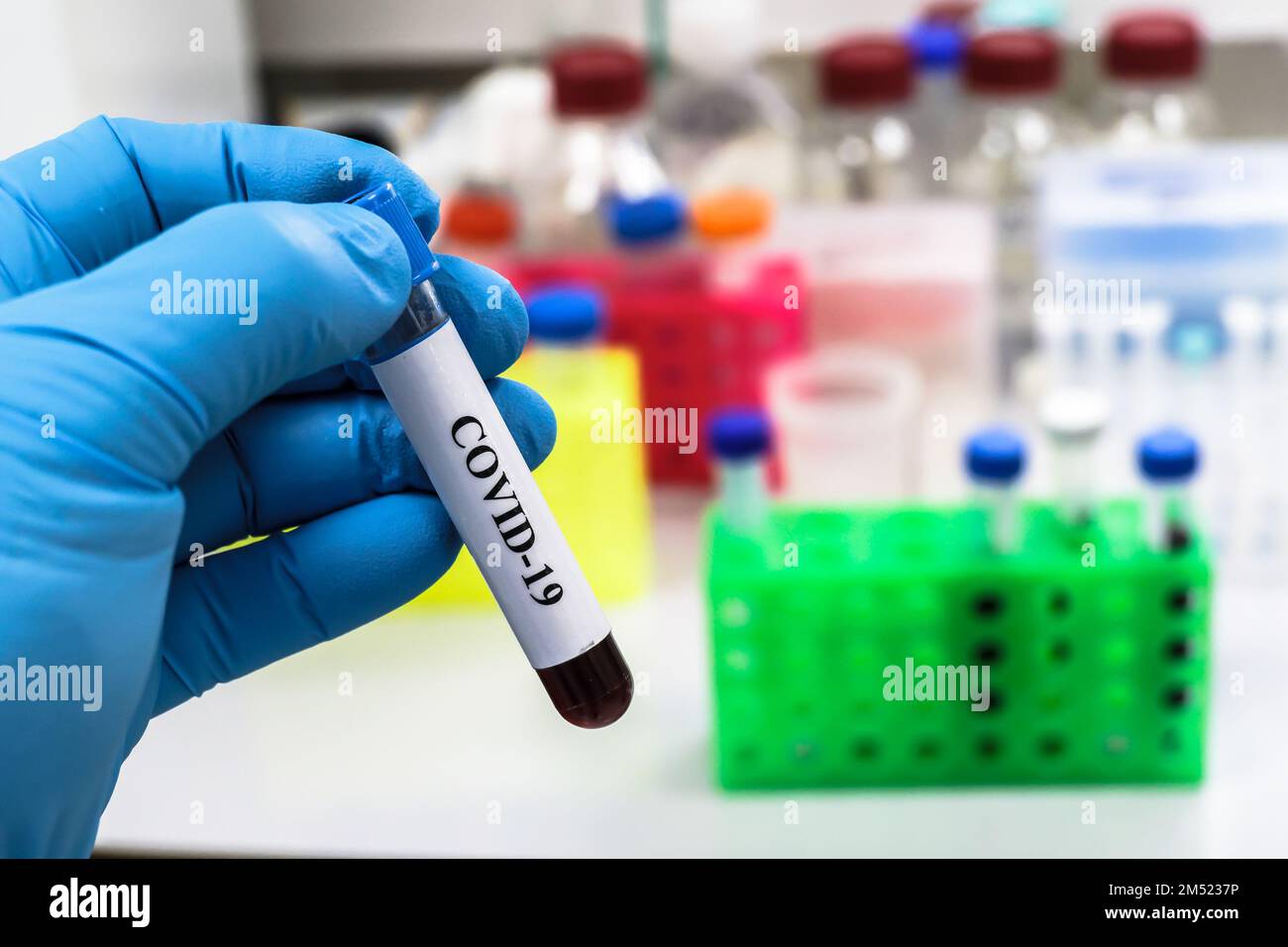 Coronavirus test. Test tube with sample for diagnosis COVID-19 Stock ...