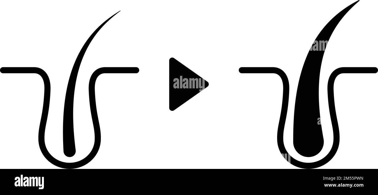 AGA (thinning hair treatment) treatment image icon, image of AGA Stock ...